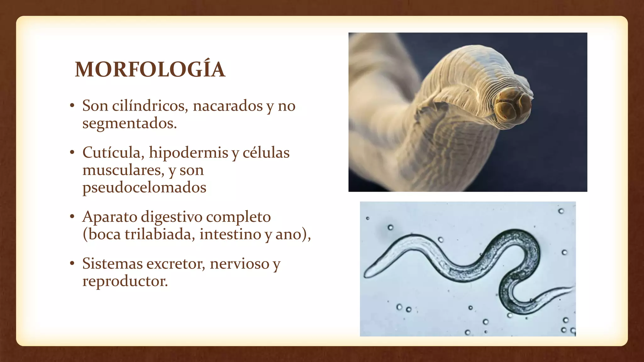 TOXOCARIASIS.pptx