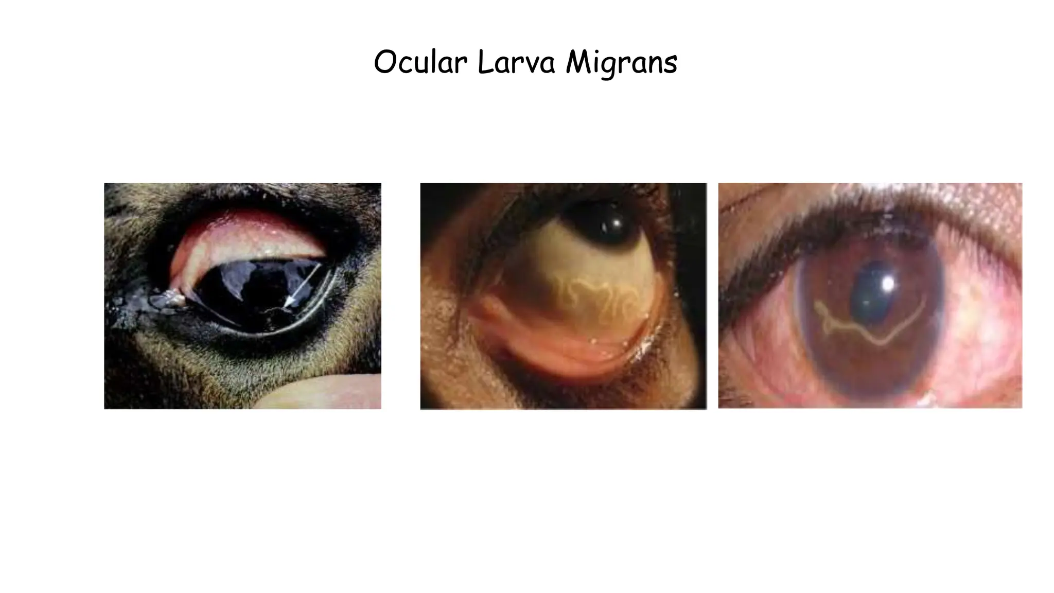 TOXOCARIASIS.pptx in depth review of toxocariasis | PPTX