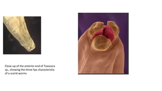 TOXOCARIASIS.pptx in depth review of toxocariasis | PPT
