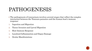 toxocariasis by ali muhammad muazzam.pptx