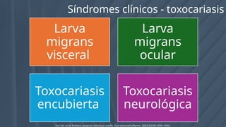 Toxocariasis ocular (Larva migrans, Toxocara canis y cati, helmintos ...