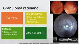 Toxocariasis ocular (Larva migrans, Toxocara canis y cati, helmintos ...