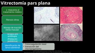Toxocariasis ocular (Larva migrans, Toxocara canis y cati, helmintos ...