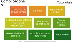 Toxocariasis ocular (Larva migrans, Toxocara canis y cati, helmintos ...