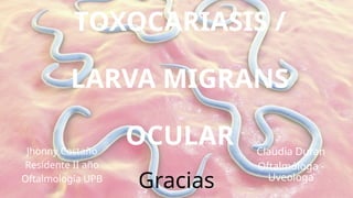 Toxocariasis ocular (Larva migrans, Toxocara canis y cati, helmintos ...