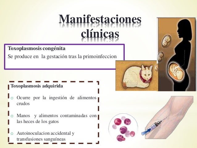 Analisis de Las caracteristicas Clinicas de la Toxoplasmosis