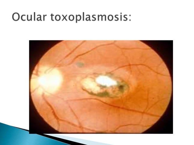 Toxoplasma gondii | PPTX