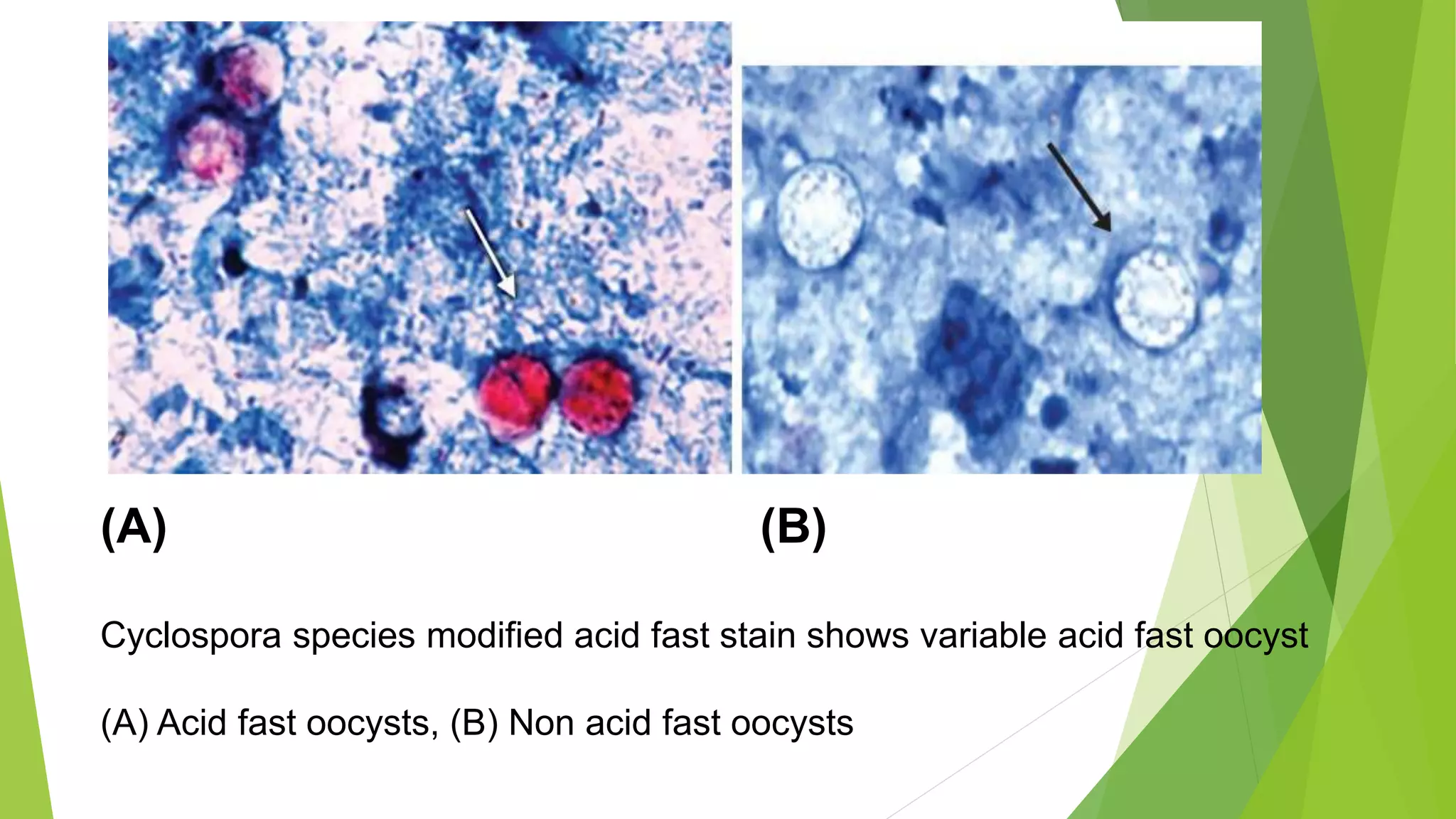 Toxoplasma gondii and cyclospora | PPTX