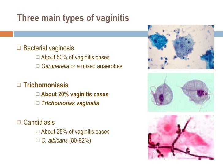 Toxoplasma+trichomonas