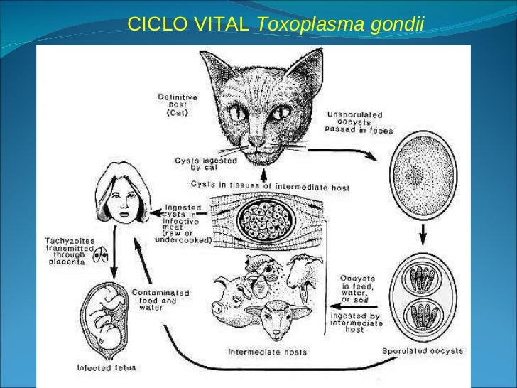 Toxoplasmosis