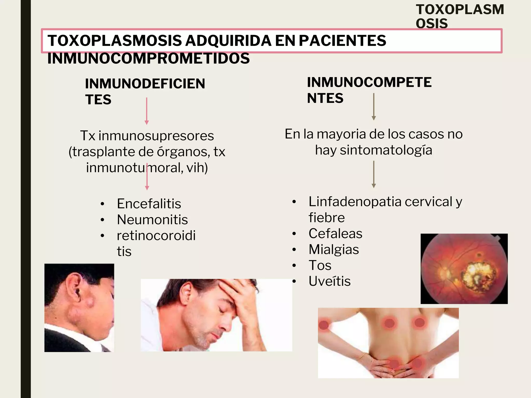 toxoplasmosis.pptx