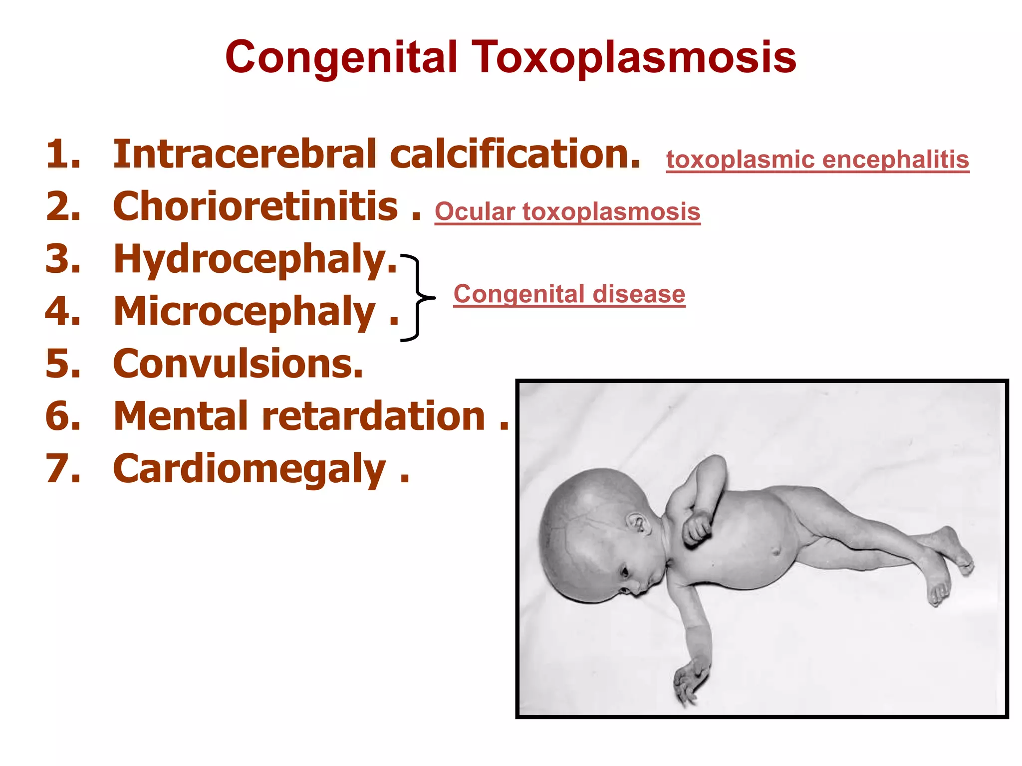 Toxoplasmosis.pptx