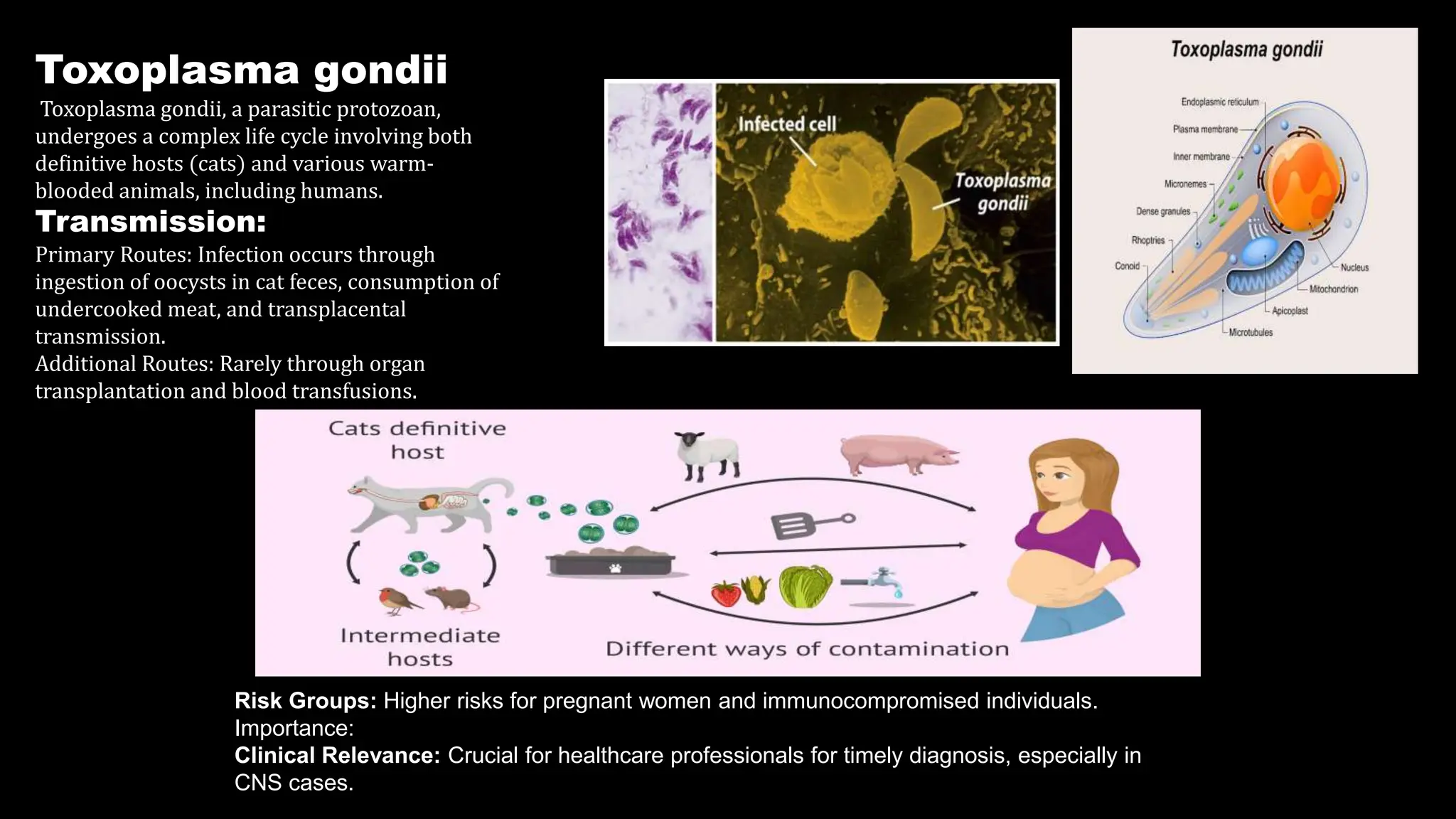 "Toxoplasmosis Associated Meningitis ( infectious disease ) | PPTX