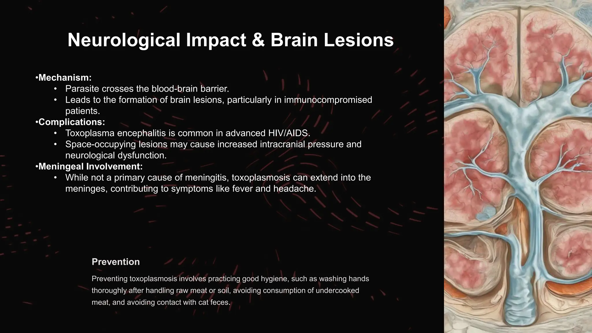 "Toxoplasmosis Associated Meningitis ( infectious disease ) | PPTX