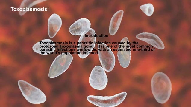 "Toxoplasmosis Associated Meningitis ( infectious disease ) | PPTX