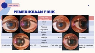 toxoplasmosis ocular caseeeeeeeeeeeeeeee | PPT