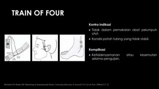 TP 1 - Train of Four - Antonius Wahyu Hendrawan_PPT.pdf