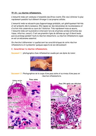 Processus De Réponse Inflammatoire