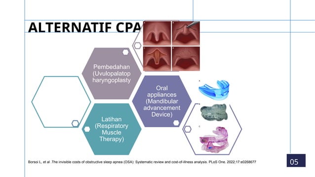 Perbaikan Fungsi Respirasi OSA dengan OMT | PPTX