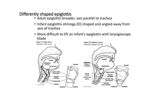 Prone Positioning on PARDS | PPT