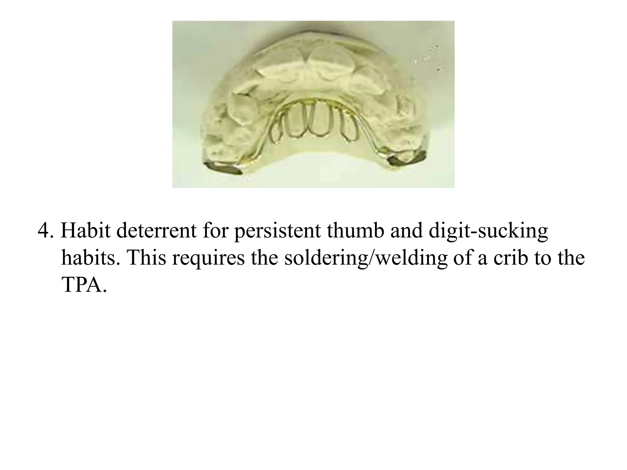 Trans Palatal Arch | PPTX