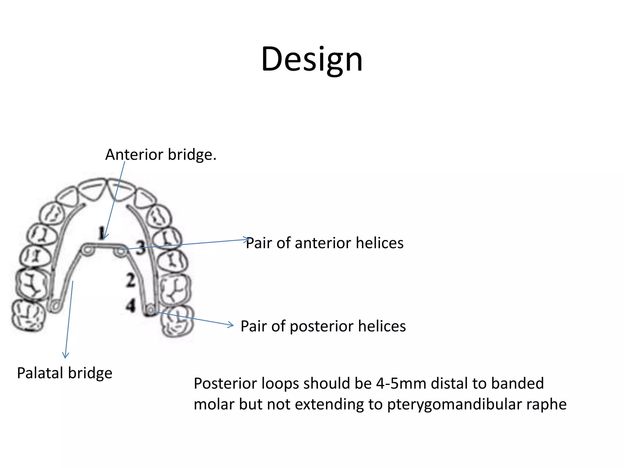 Trans Palatal Arch | PPTX