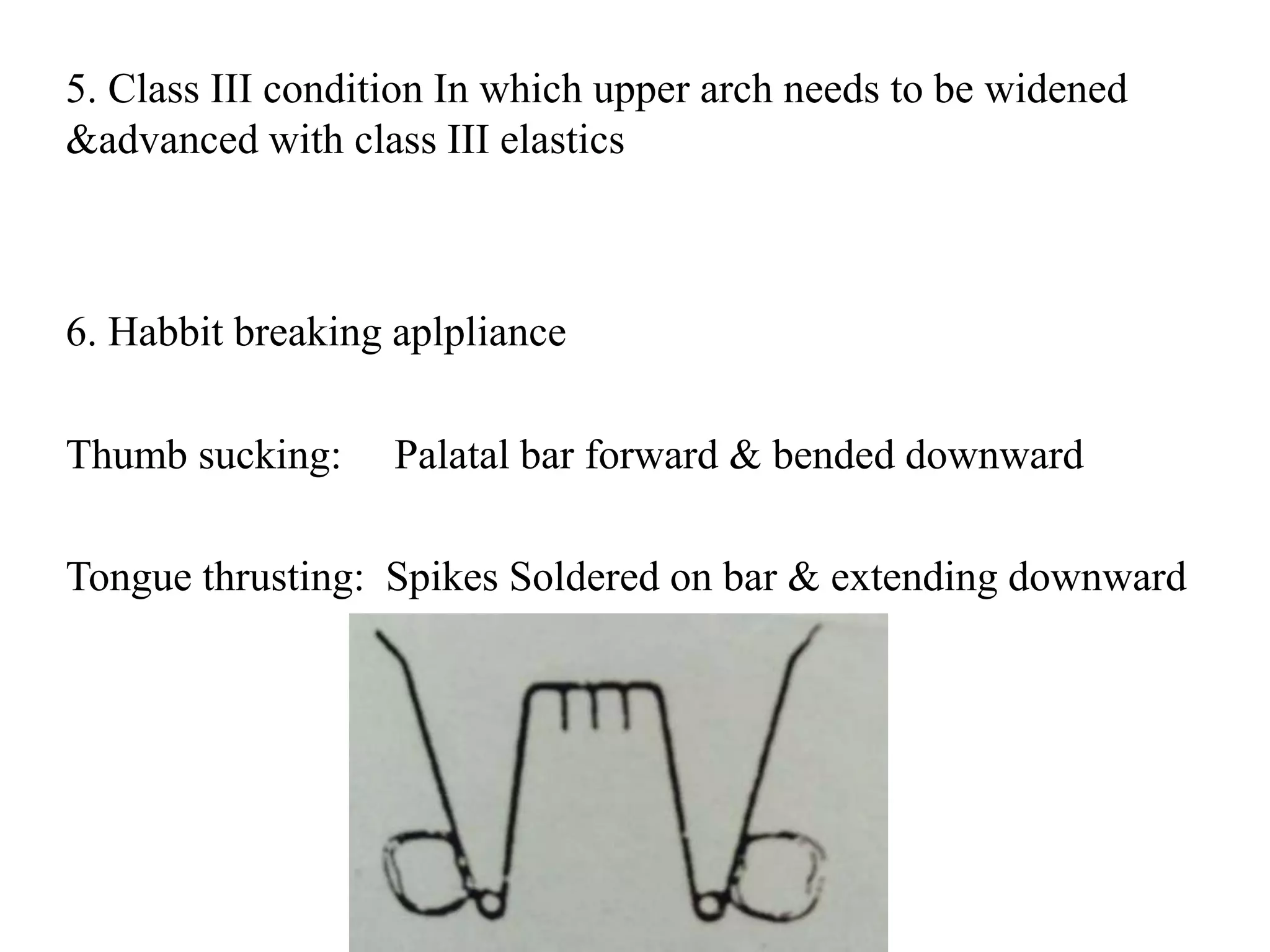 Trans Palatal Arch | PPTX