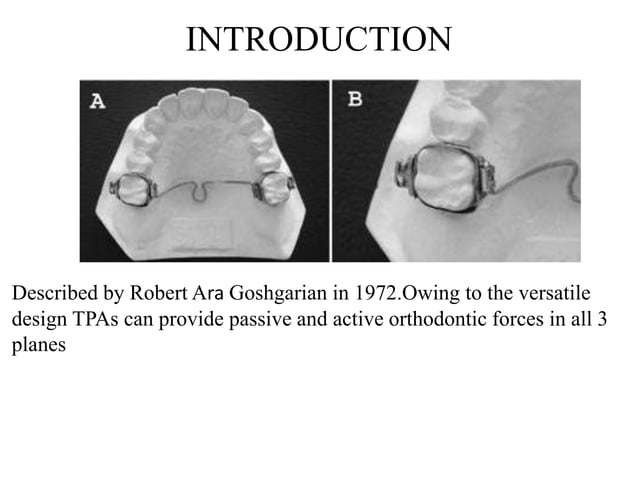 Trans Palatal Arch | PPTX | Dental Health | Diseases and Conditions