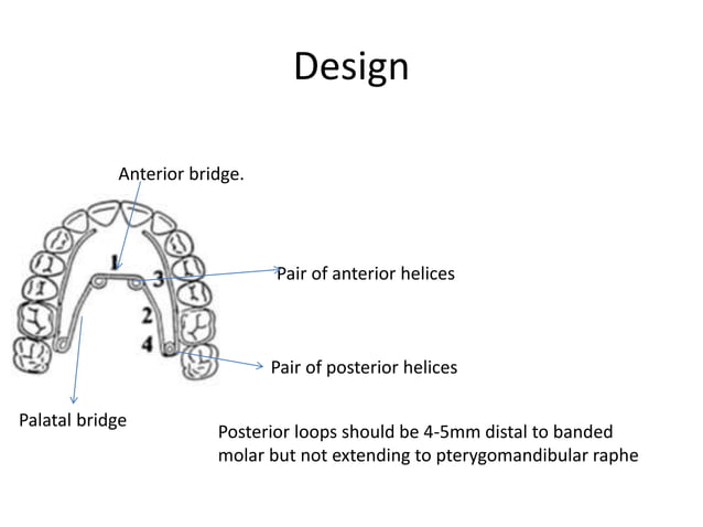 Trans Palatal Arch | PPTX | Dental Health | Diseases and Conditions