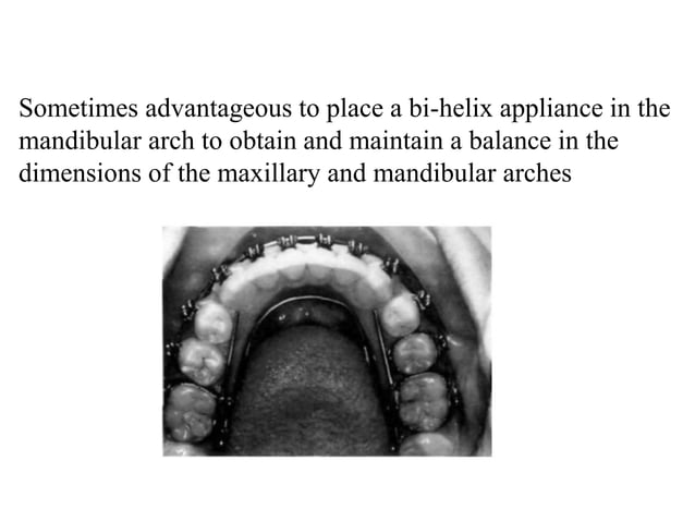 Trans Palatal Arch | PPTX | Dental Health | Diseases and Conditions