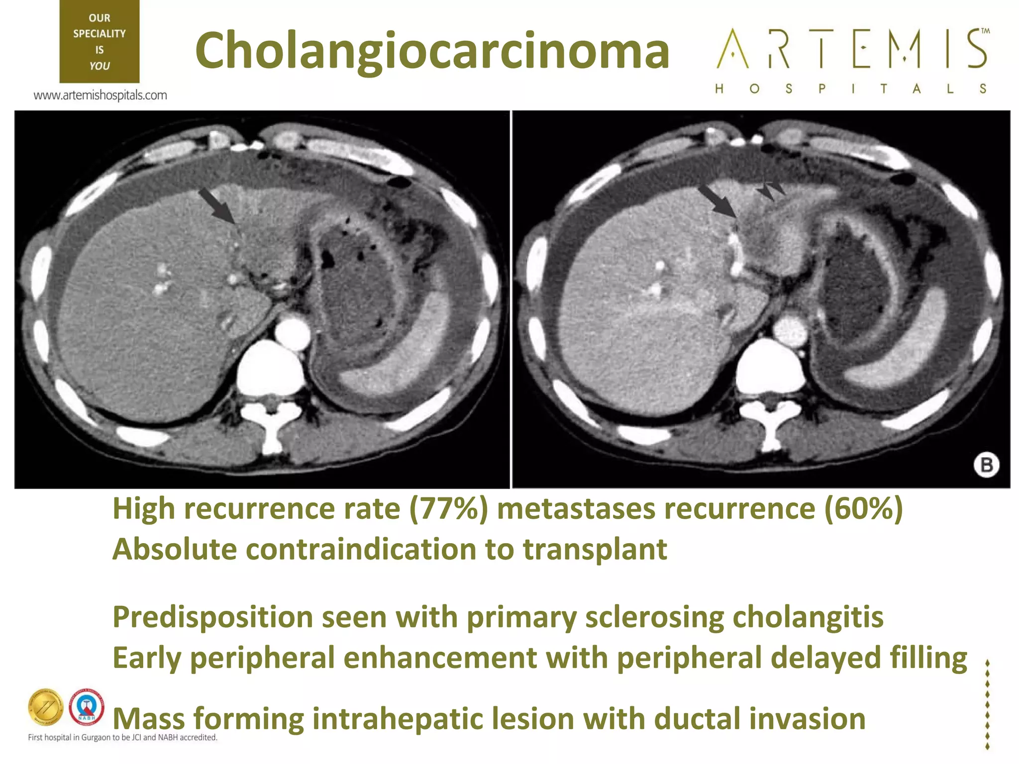 TPCT - Triphasic CT Scan - Liver | PPT