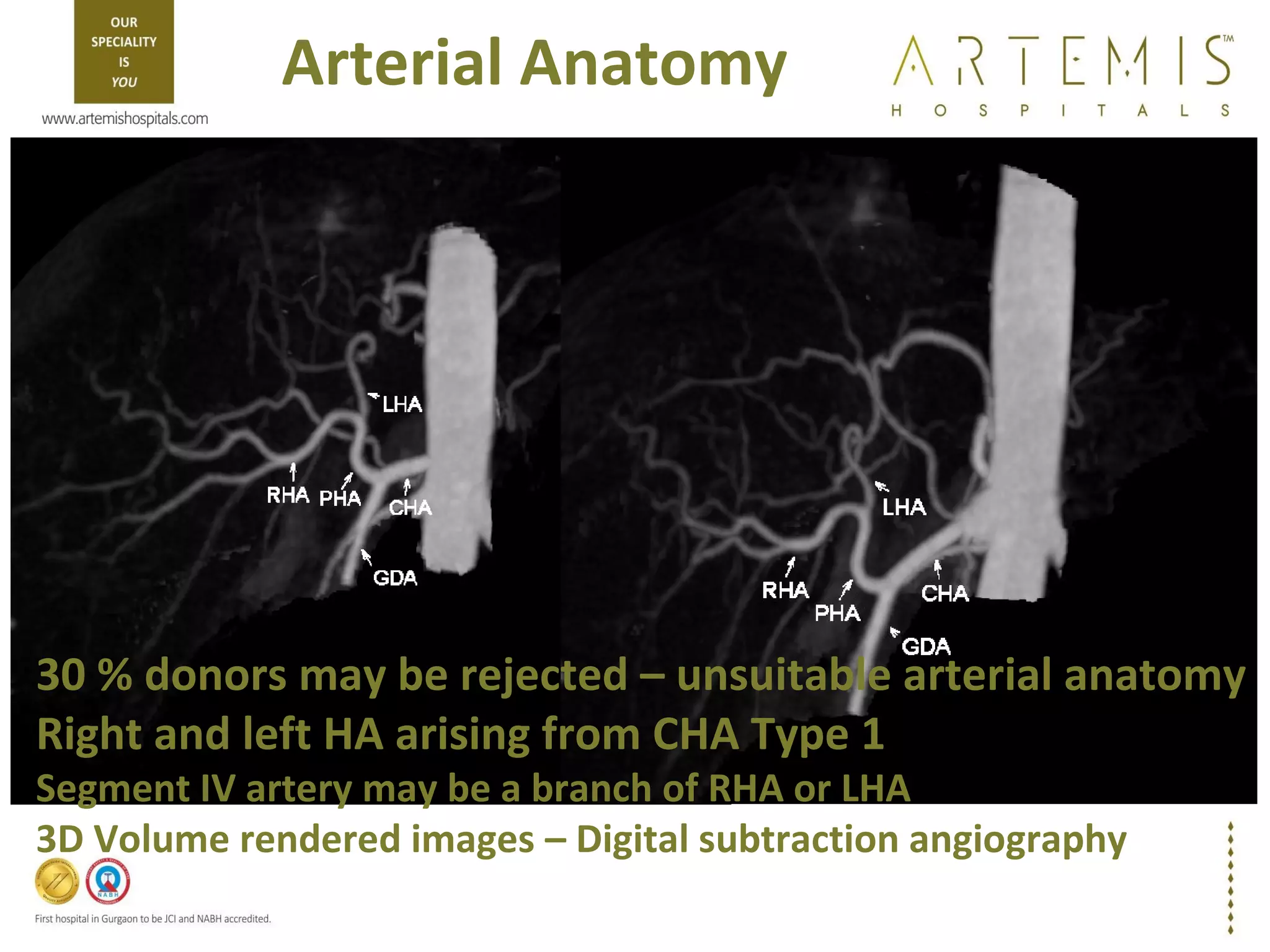 TPCT - Triphasic CT Scan - Liver | PPT