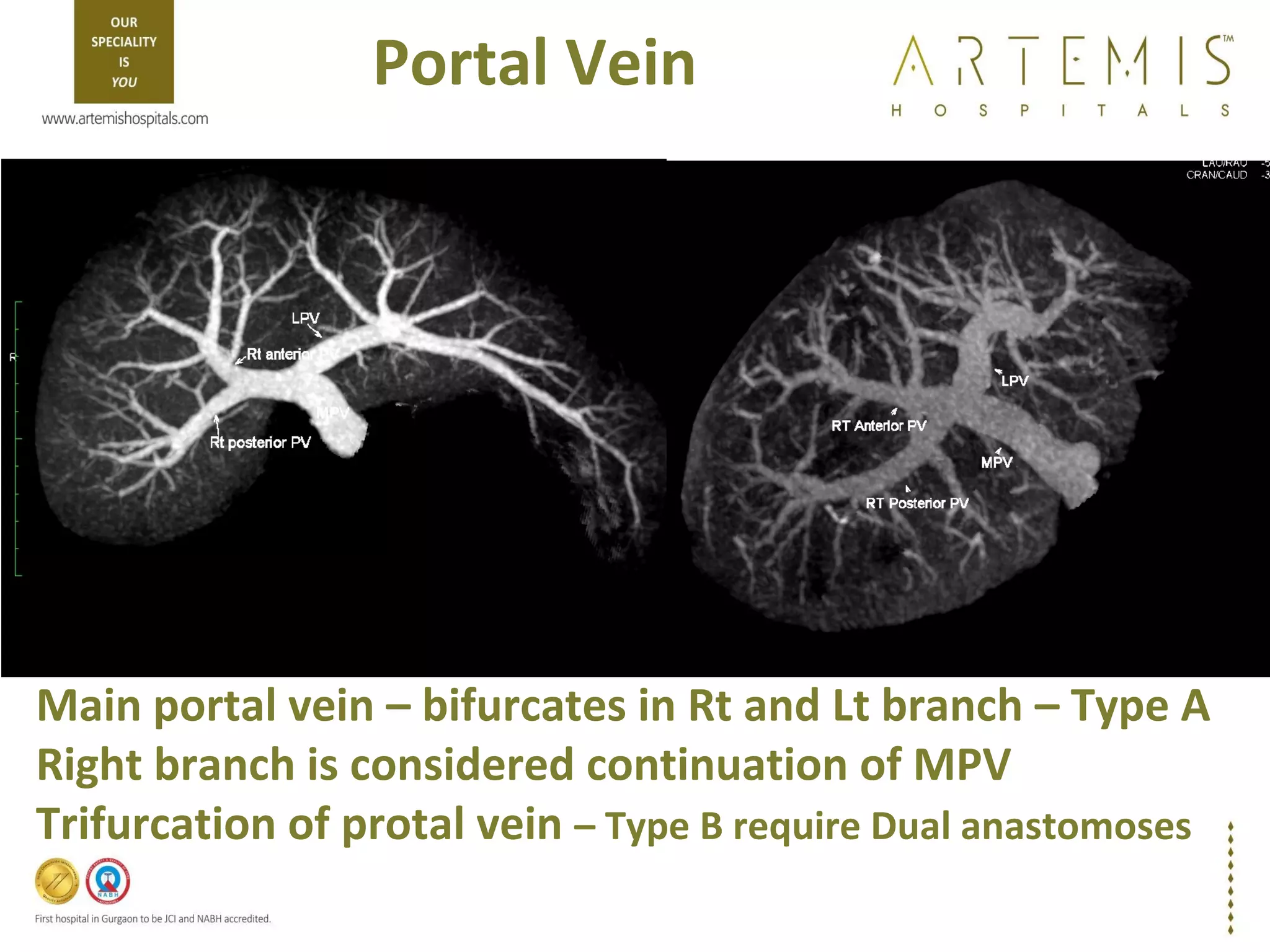TPCT - Triphasic CT Scan - Liver | PPT