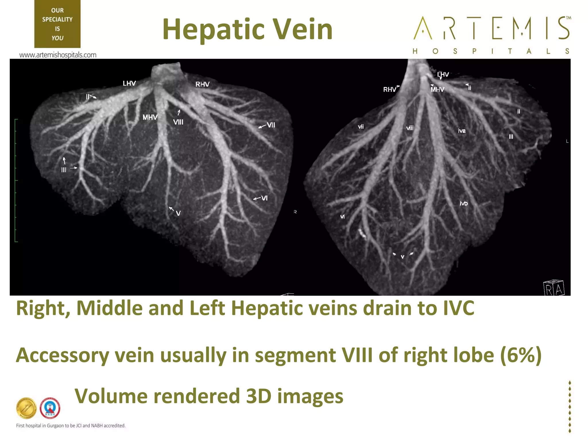 TPCT - Triphasic CT Scan - Liver | PPT
