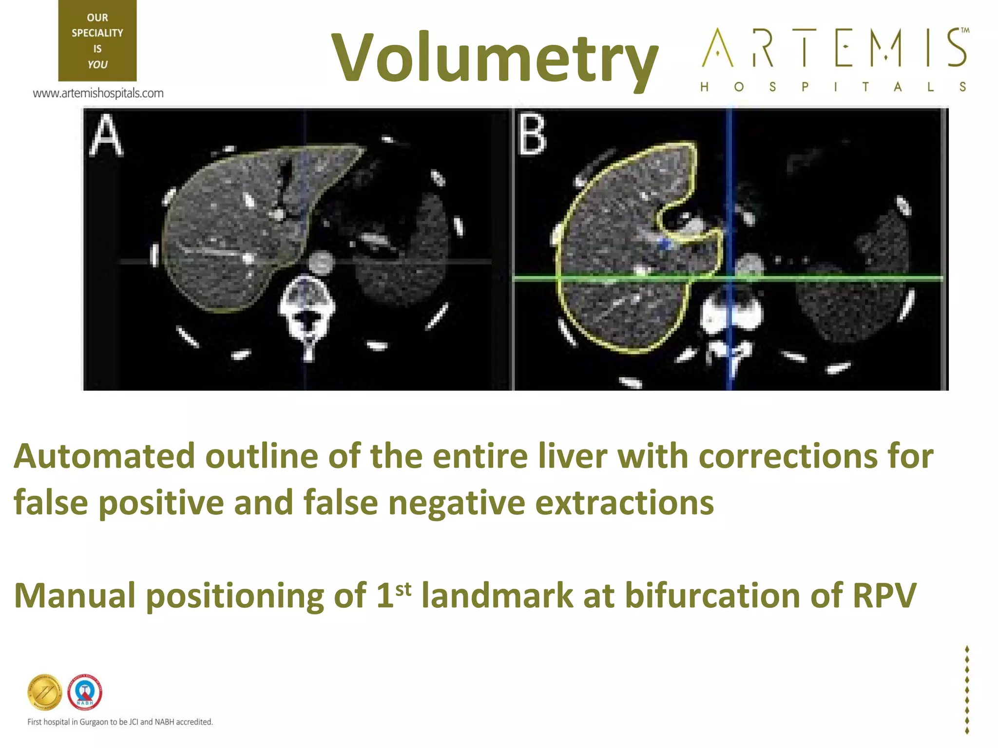 TPCT - Triphasic CT Scan - Liver | PPT
