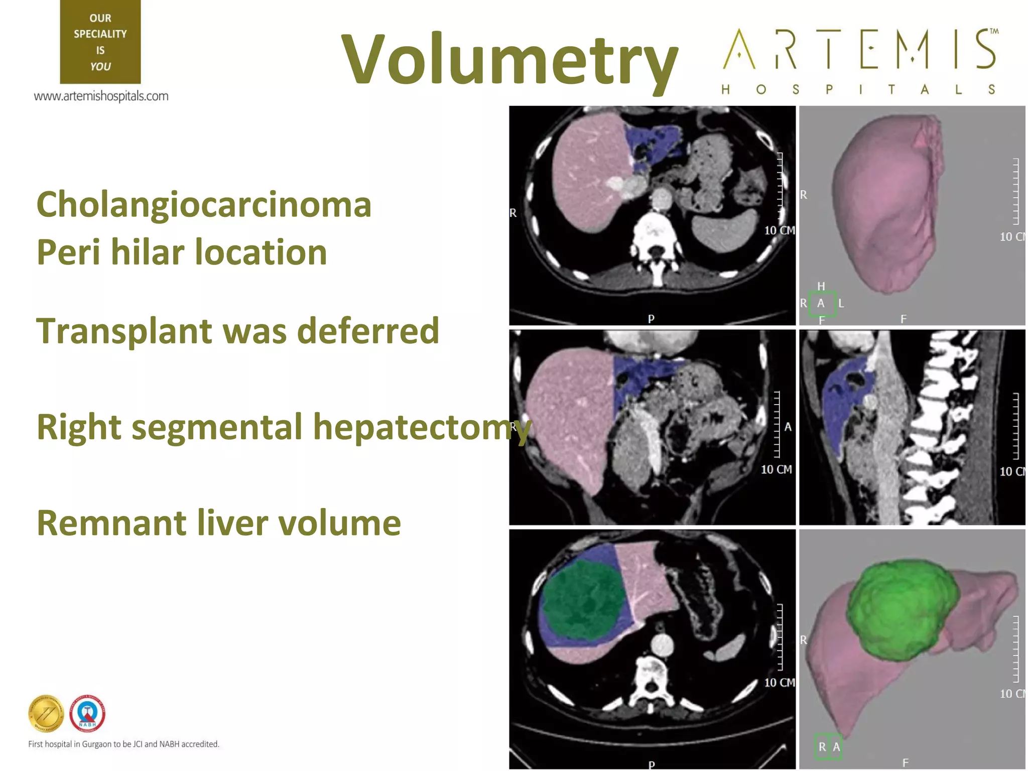 TPCT - Triphasic CT Scan - Liver | PPT