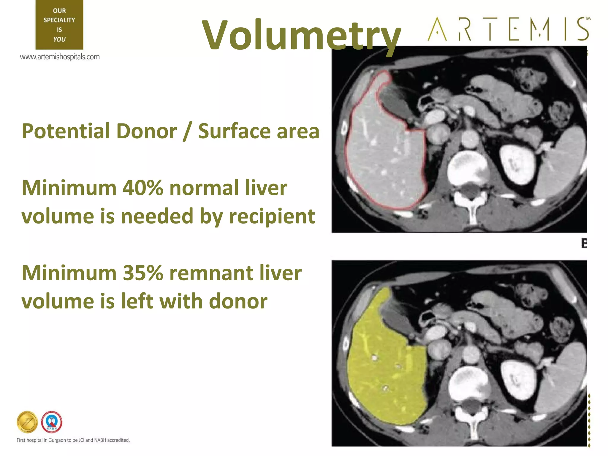 TPCT - Triphasic CT Scan - Liver | PPT