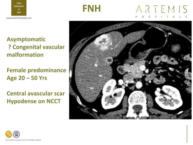 TPCT - Triphasic CT Scan - Liver | PPT