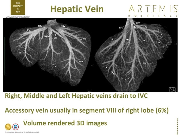 TPCT - Triphasic CT Scan - Liver | PPT