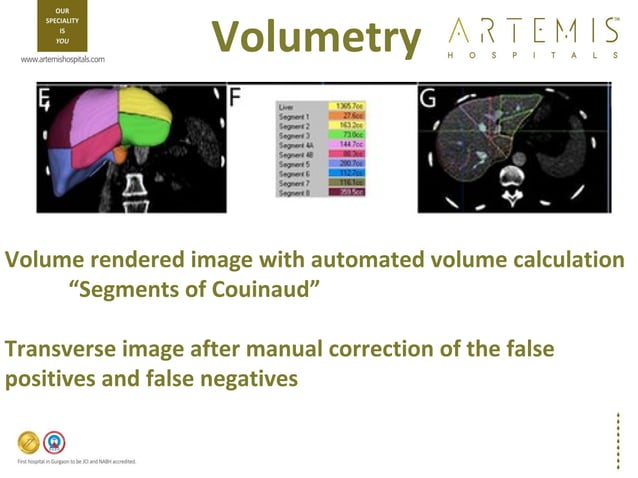 TPCT - Triphasic CT Scan - Liver | PPT