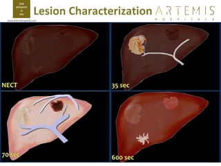 TPCT - Triphasic CT Scan - Liver | PPT