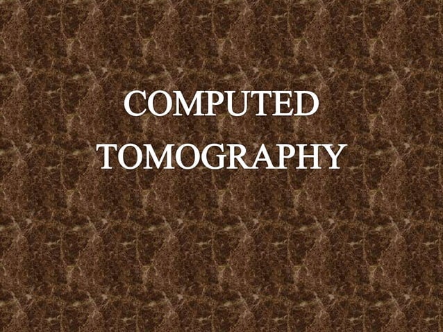 TETRALOGY OF FALLOT AND TET SPELL presentation | PPTX | Heart and ...