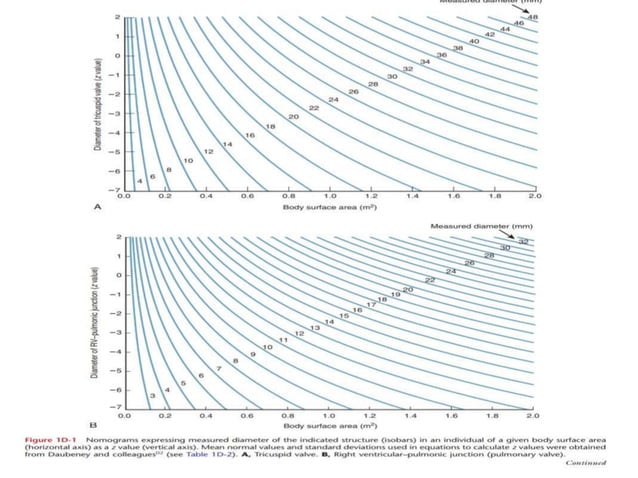 TETRALOGY OF FALLOT AND TET SPELL presentation | PPTX | Heart and ...