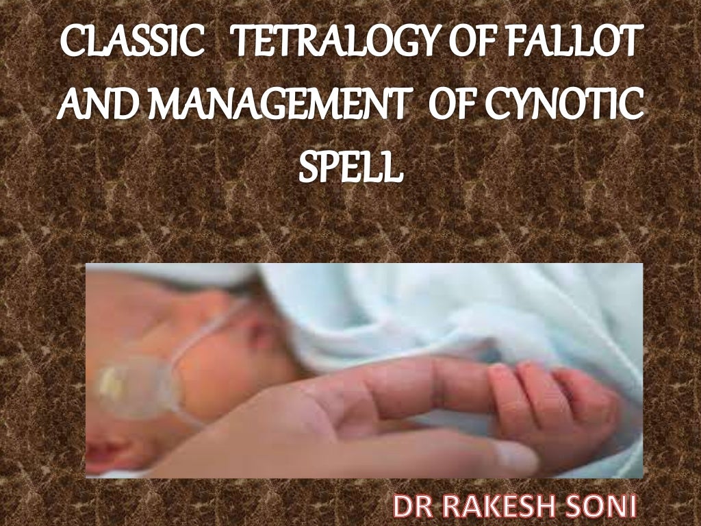 TETRALOGY OF FALLOT AND TET SPELL presentation