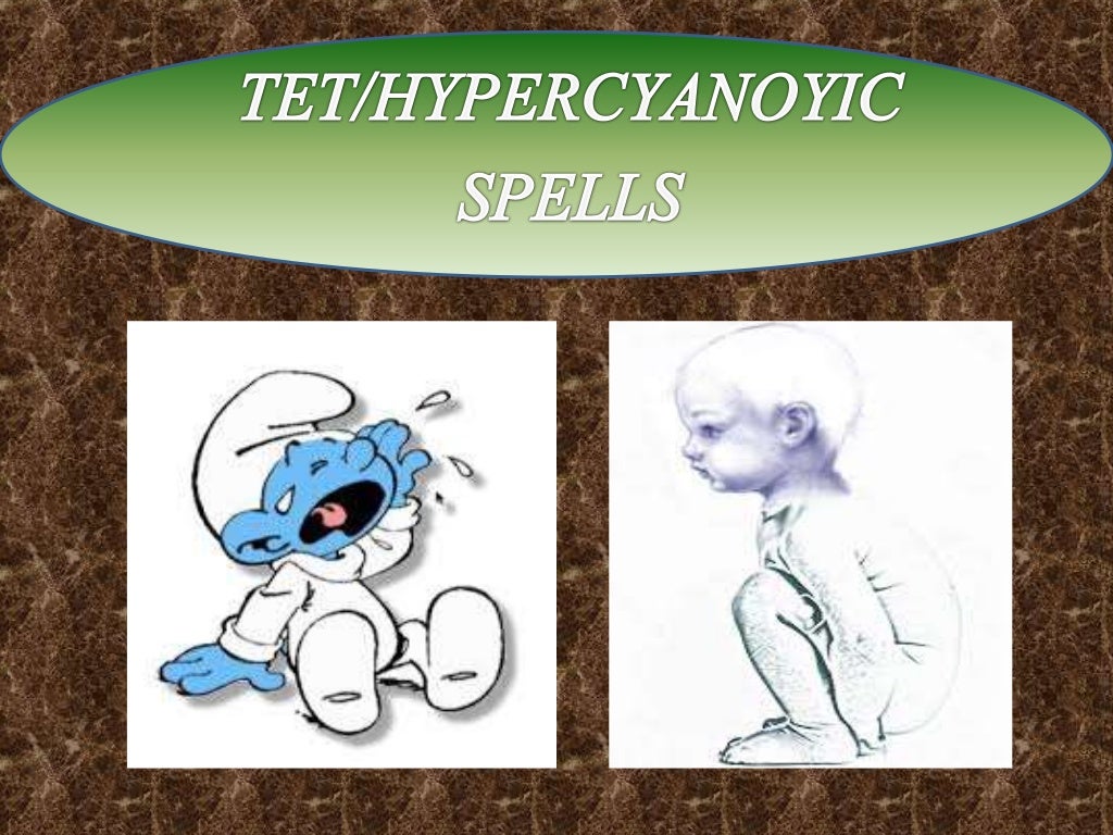TETRALOGY OF FALLOT AND TET SPELL presentation