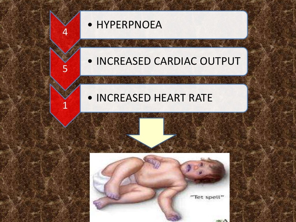 TETRALOGY OF FALLOT AND TET SPELL presentation