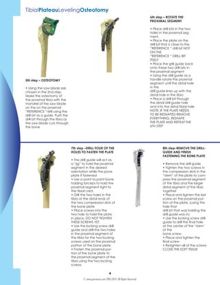 Tplo Tibial Plateau Leveling Osteotomy) surgical instruments | PDF
