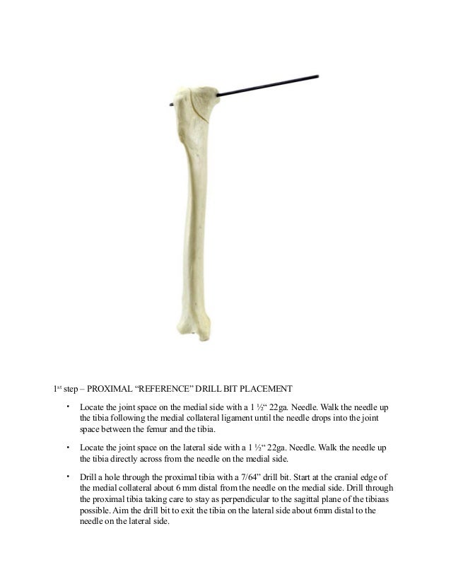 TPLO Procedure (Tibial Plateau Leveling Osteotomy) surgical instrumen…