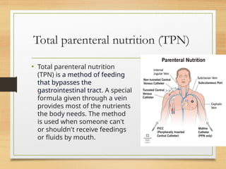 total parentral nutrition policy general | PPTX