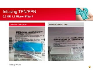 Tpn vs ppn | PPT
